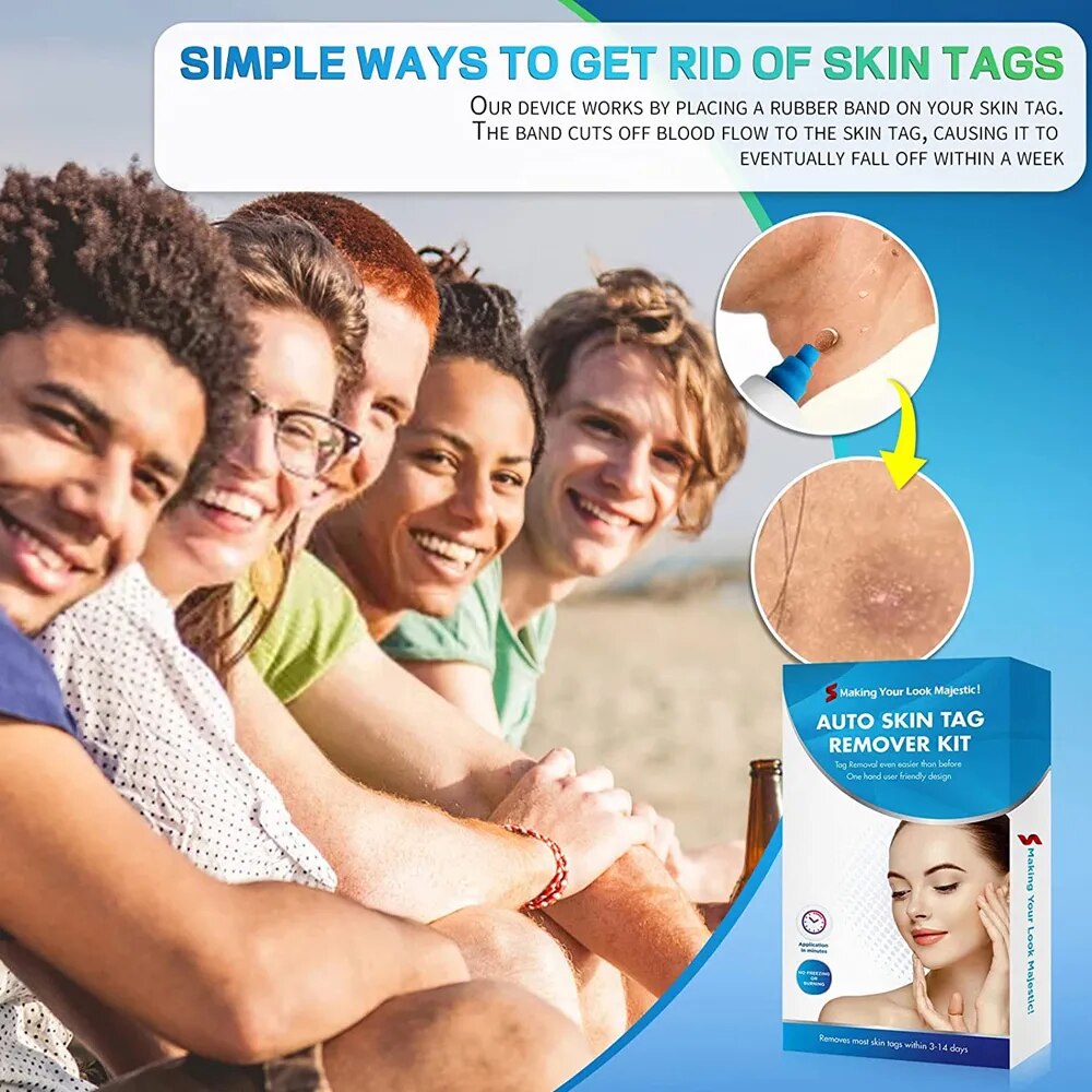 2 IN 1 Auto Micro Skin Tag Remover - Home Goods, Clothing & Accessories ...