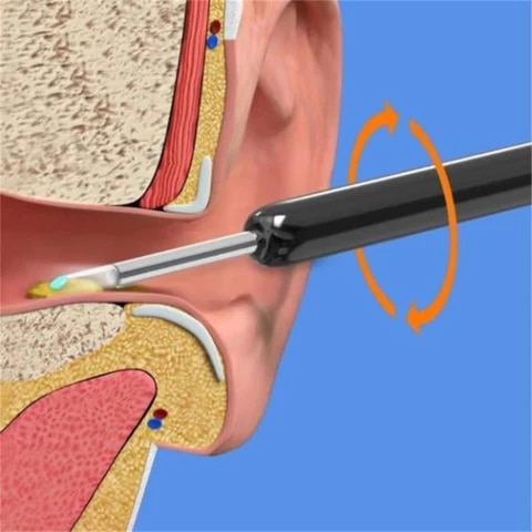 Smart Ear Endoscope HD - Awessories